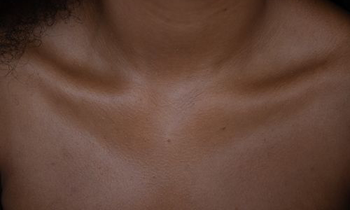 How To Look After Your Décolletage? | LIHA BEAUTY – LIHA Beauty